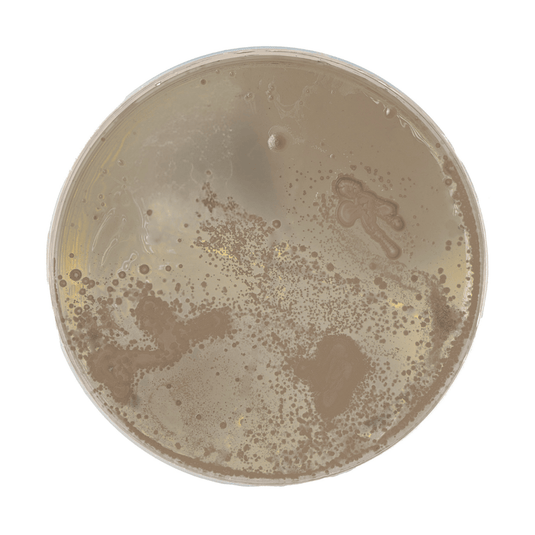 Willow Bark Extract | Gentle Exfoliation & Clarifying Benefits ...